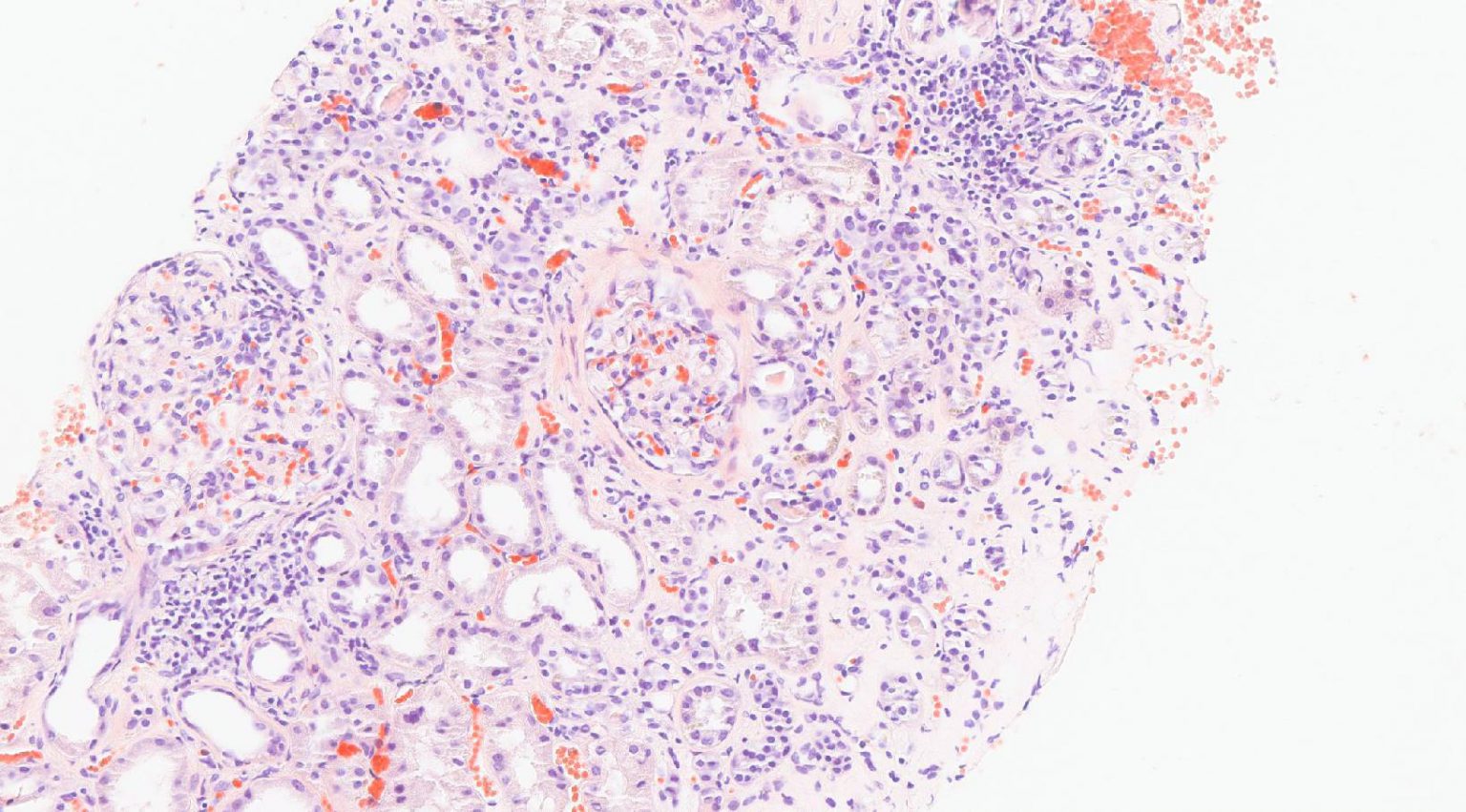 IHC & IF & Special Stains – Pacific Rim Pathology