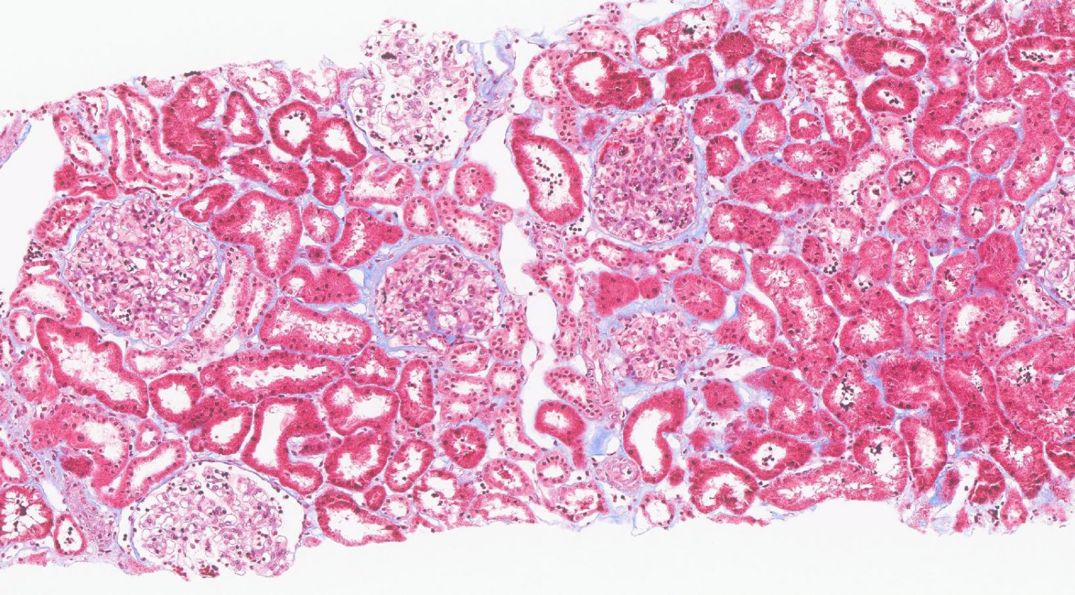 IHC & IF & Special Stains – Pacific Rim Pathology